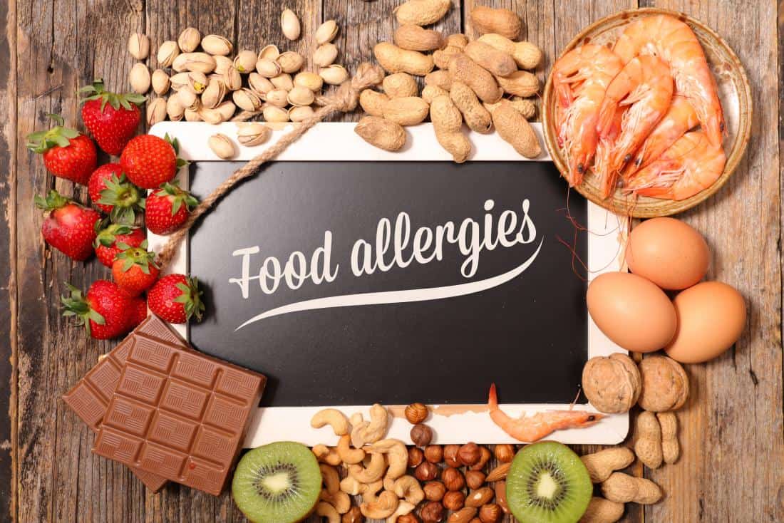 Food Allergies and Intolerances | Dietitian in Nelspruit